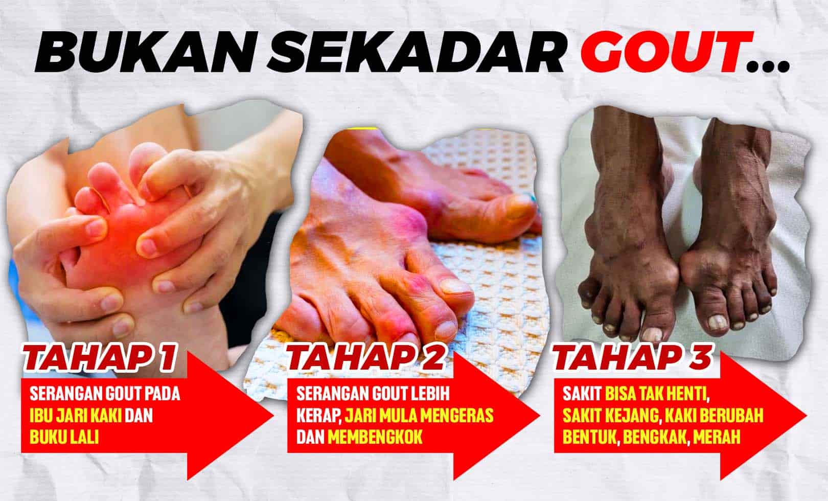 Eurika - Solusi Masalah Sendi, Gout & Batu Karang